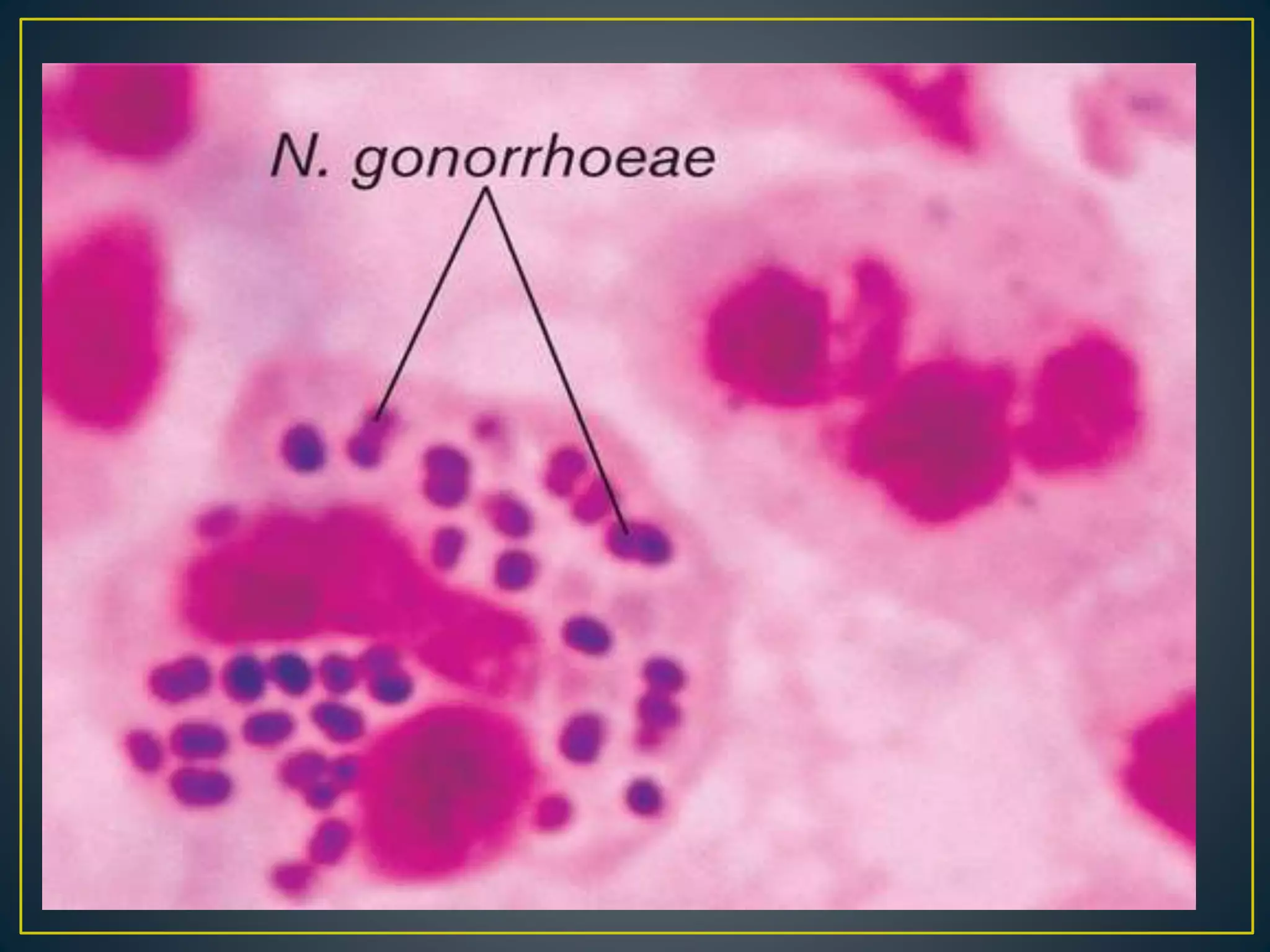 Gonococci | PPTX