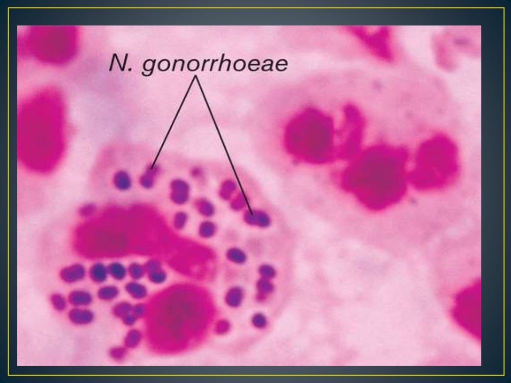 Gonococci