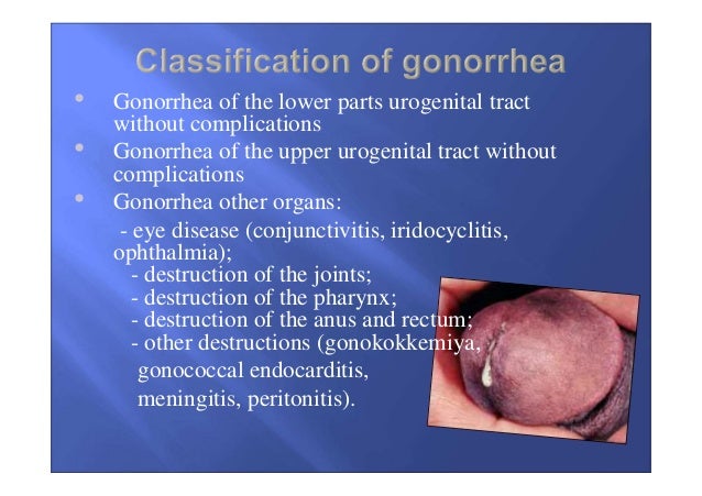 Gonorrhea