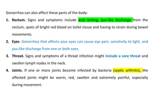 Gonorrhea converted | PPT