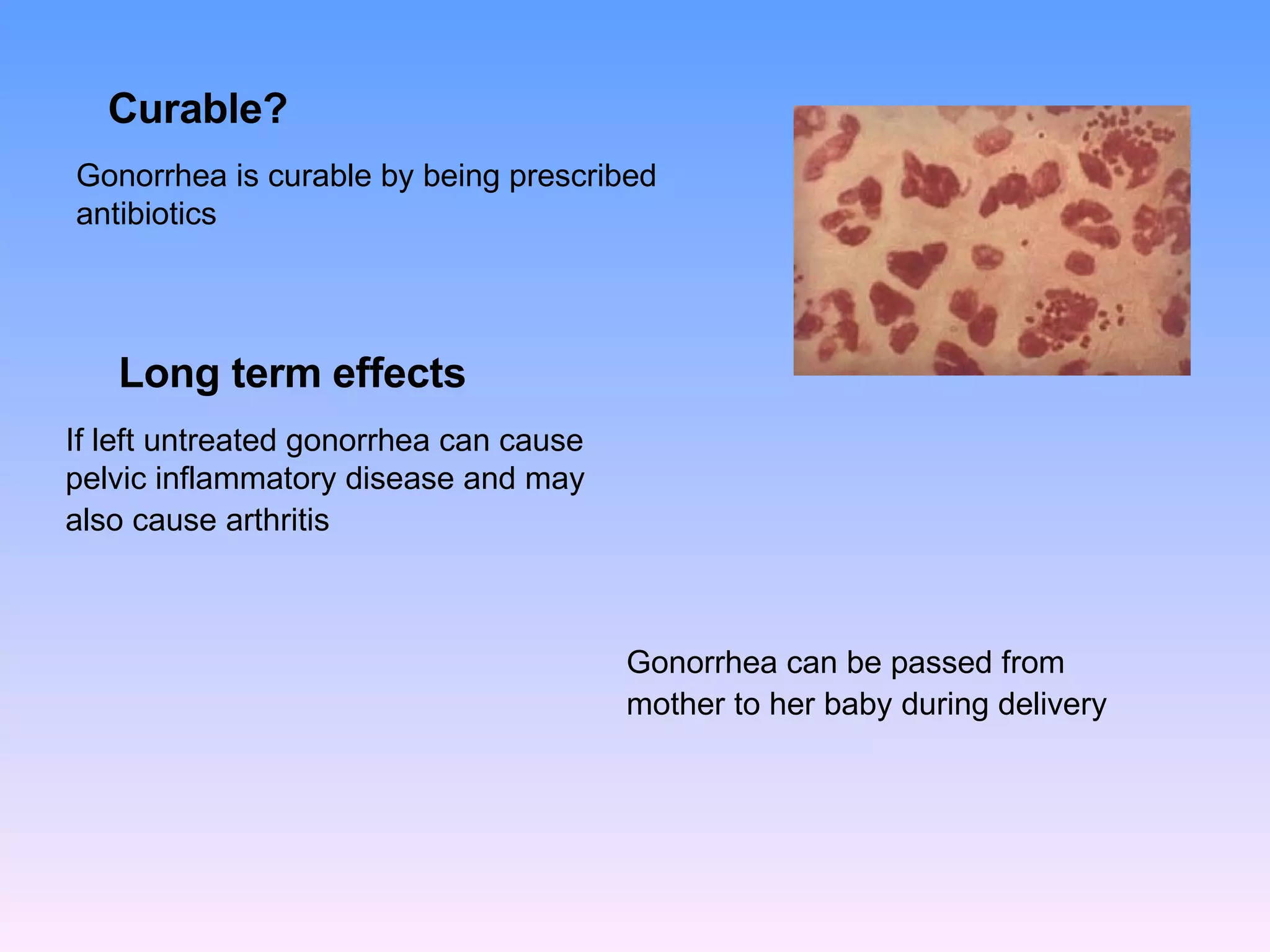 Gonorrhea Danielle Welch | PPT