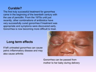 Gonorrhea Danielle Welch2 | PPT