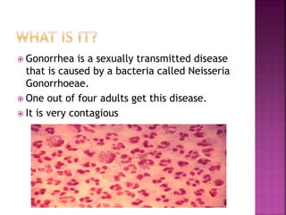 Gonorrhea powerpoint joe adamski | PPTX