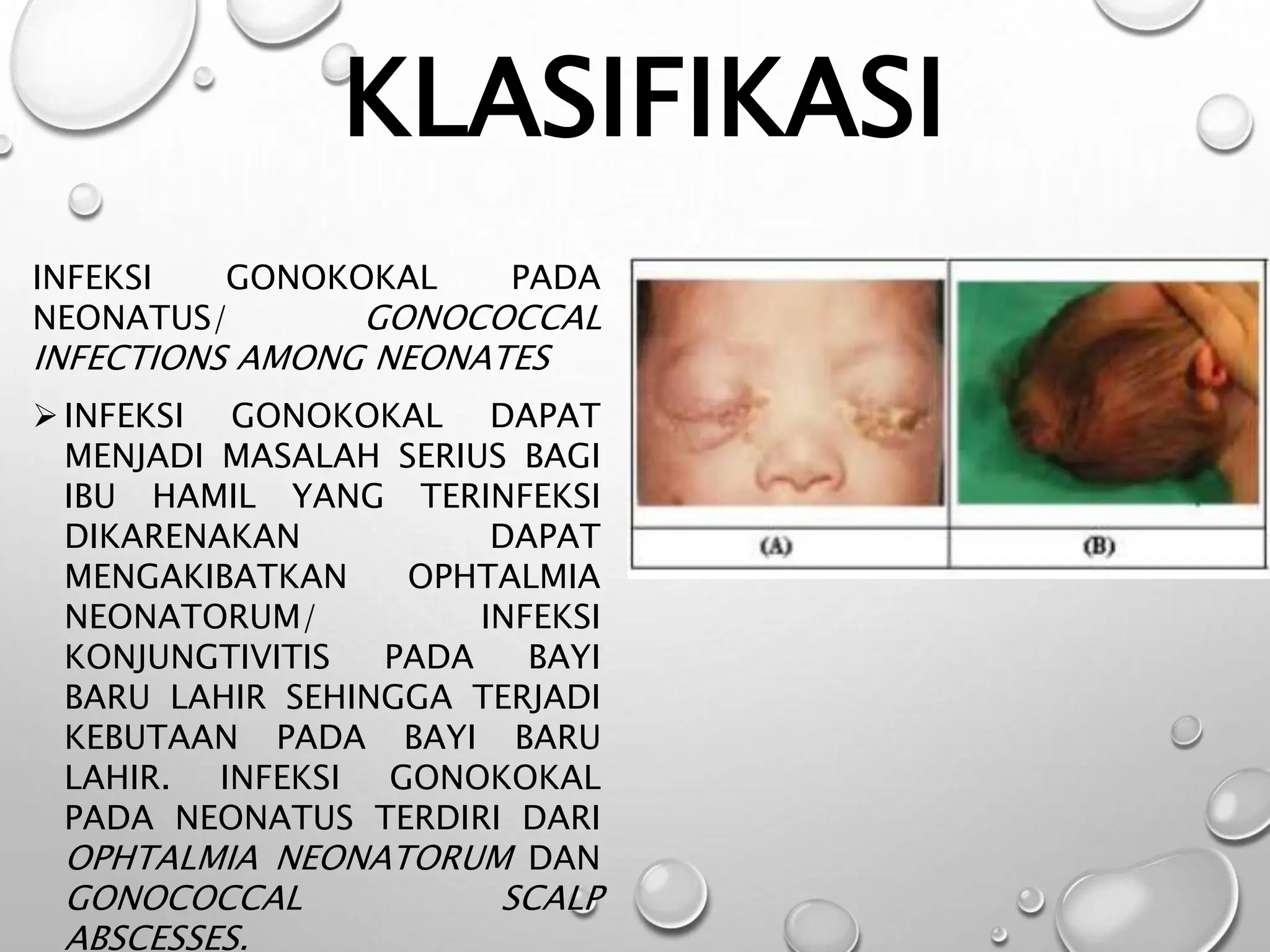 Tanda penyakit gonorrhea dan sifilis yang perlu anda ketahuk | PPTX