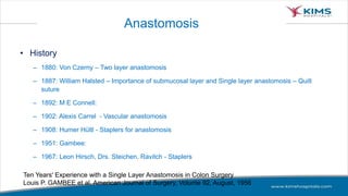 Good Intestinal Anastomosis.pptx