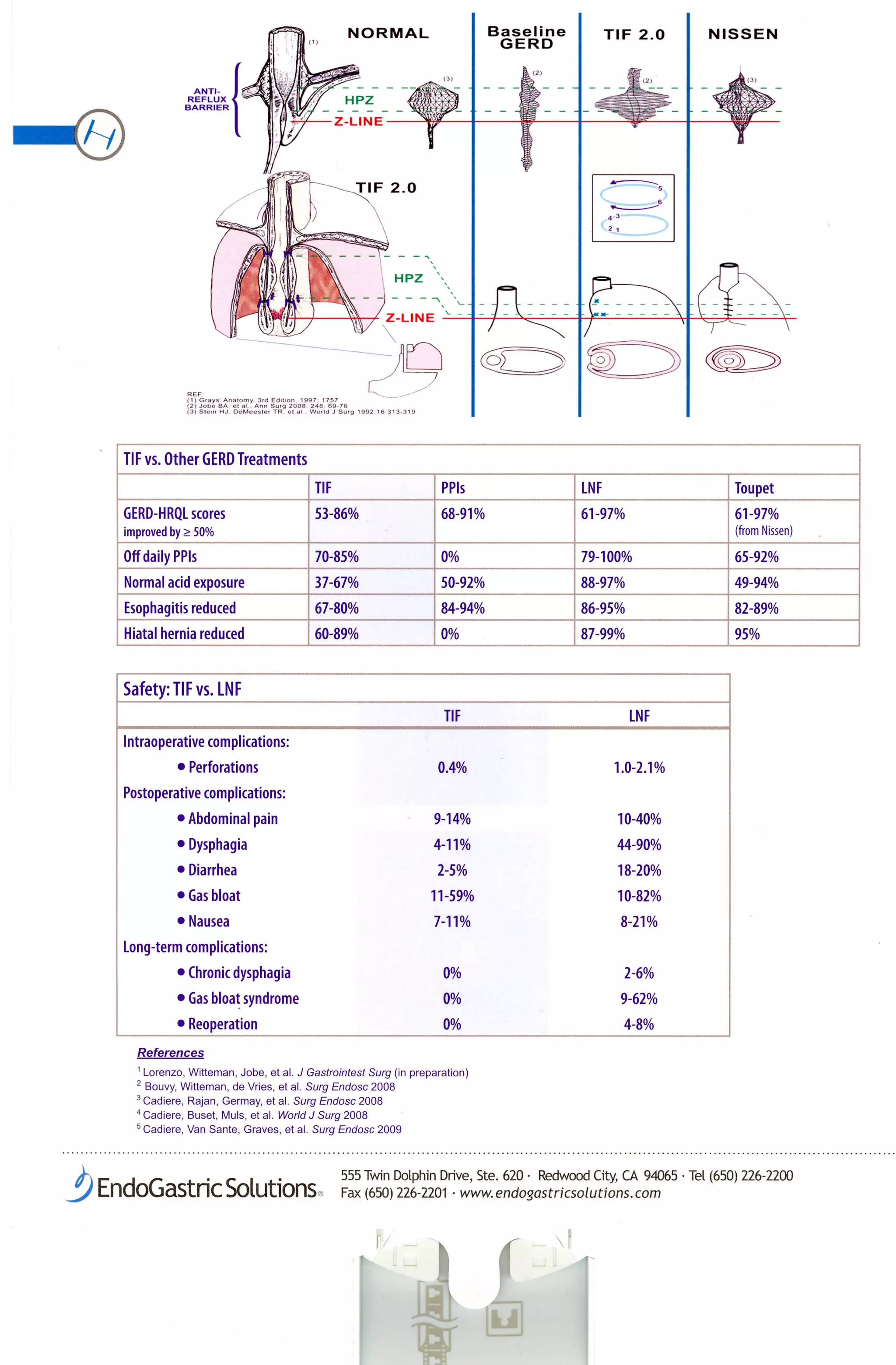 Is it a lap Nissen or an endoscopic fundoplication | PDF