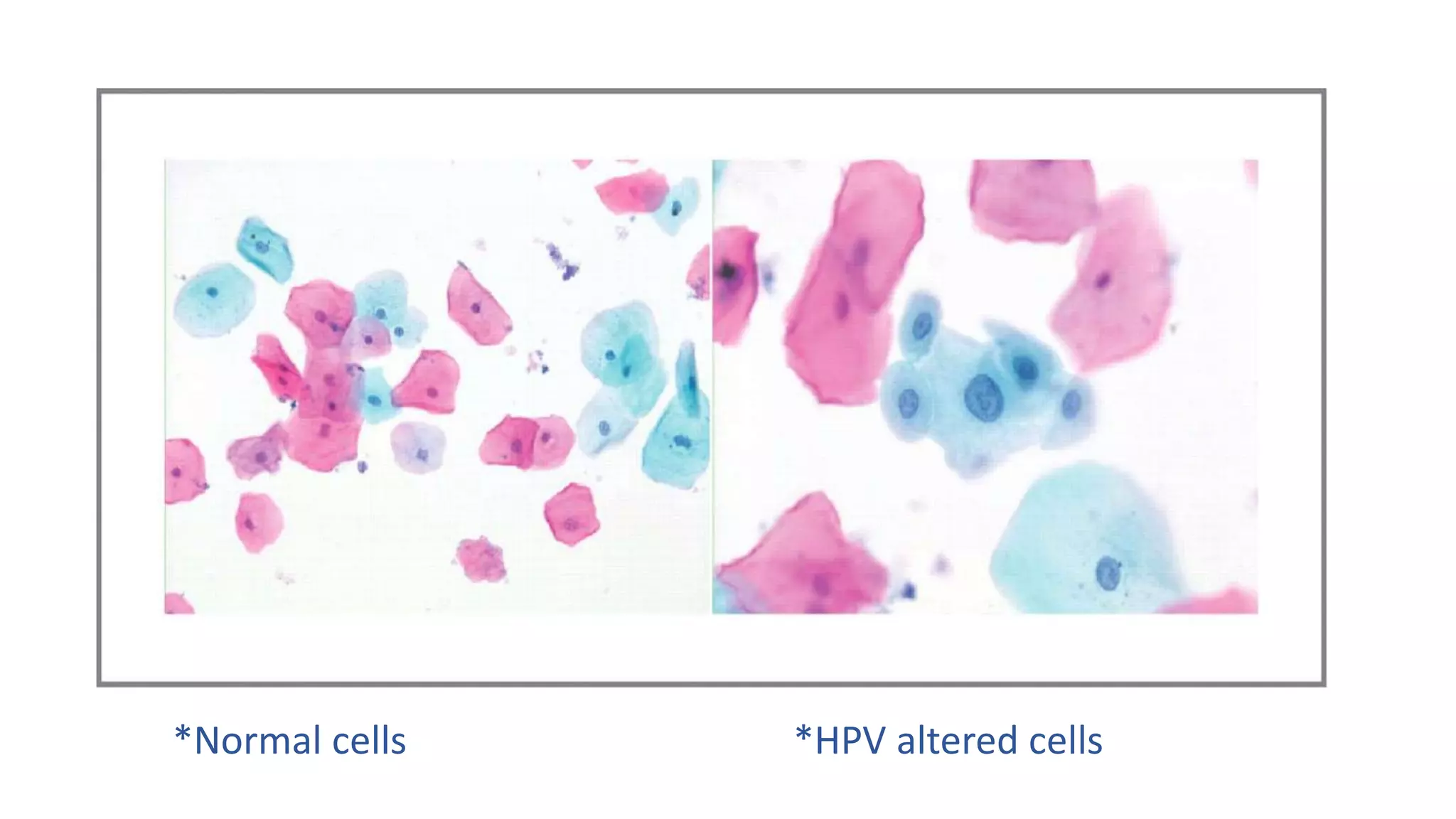 exfoliative cytology and fnac.pptx