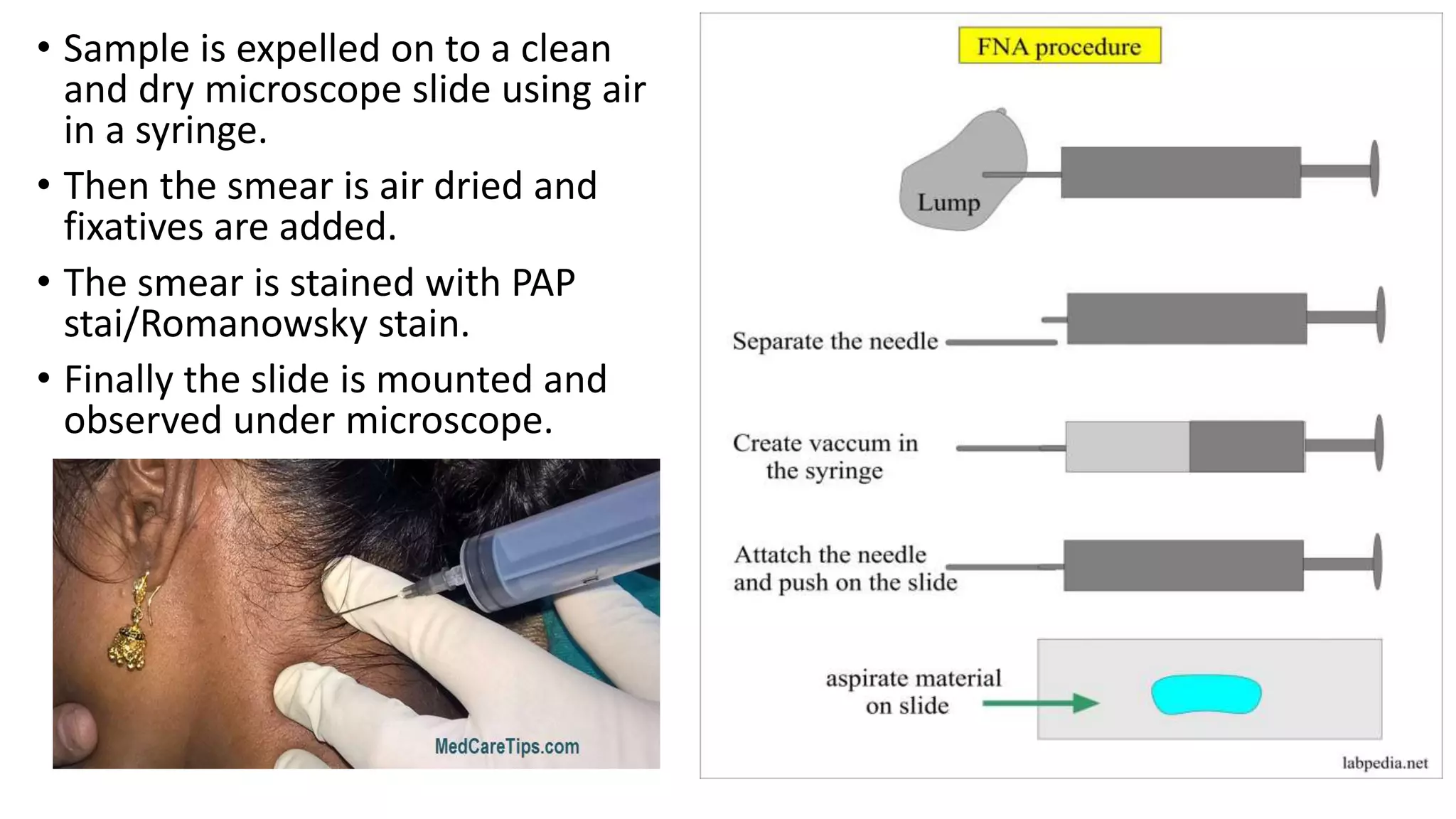 exfoliative cytology and fnac.pptx