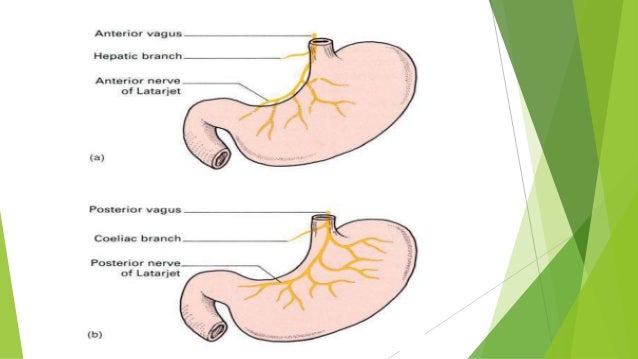 Gastric Outlet Obstruction (GOO)