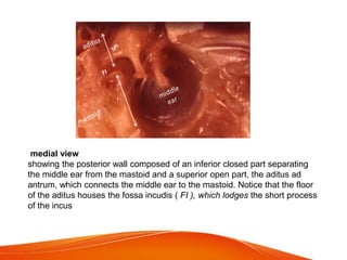 Anatomy of middle ear .................. | PPTX
