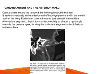 Anatomy of middle ear .................. | PPTX