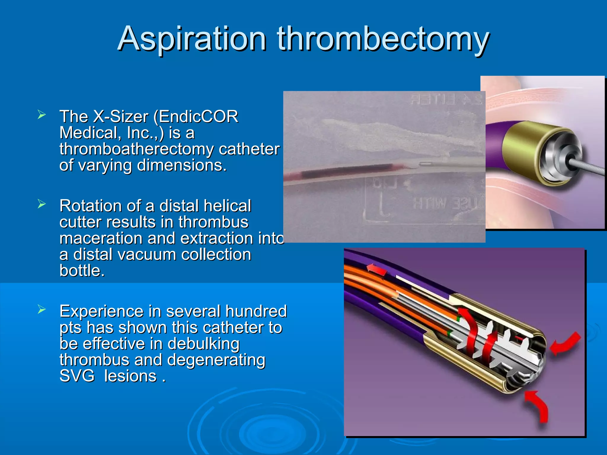 saphenous venous graft interventions | PPT