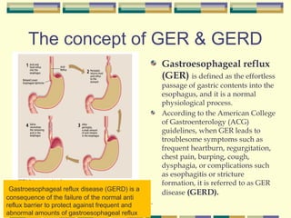 Comprehensive Overview of Gastro-Oesophageal Reflux Disease (GORD ...