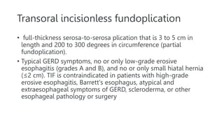 GORD management in adults, treatment, inverstigation | PPTX