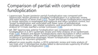 GORD management in adults, treatment, inverstigation | PPT