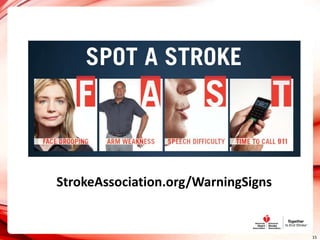 FAST Stroke Presentation | PPTX