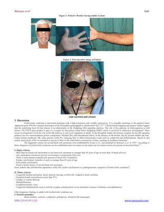 Gorlin goltz syndrome | PDF