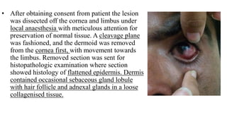 LIMBAL DERMOID -HAIRY EYEBALL | PPT