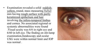 LIMBAL DERMOID -HAIRY EYEBALL | PPTX