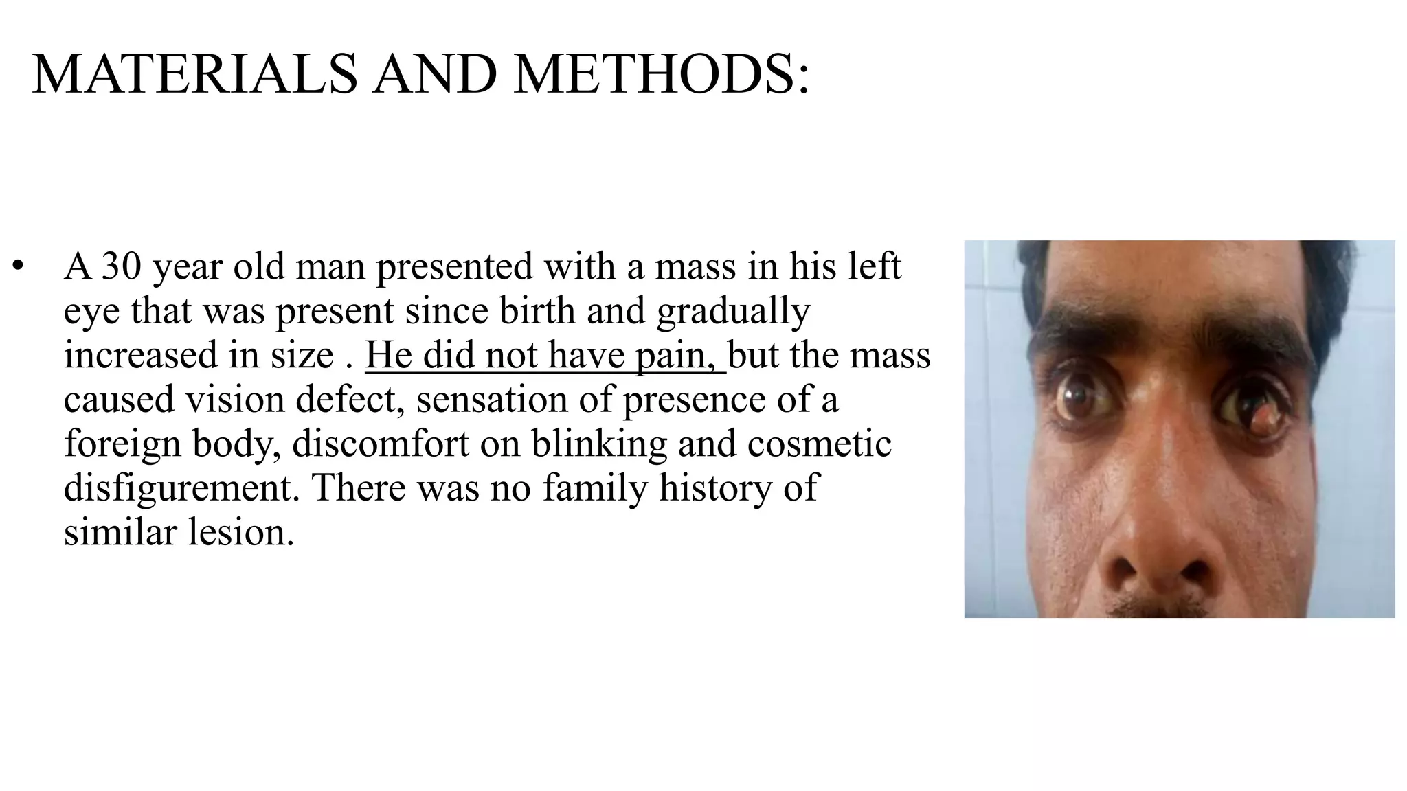 THE HAIRY EYEBALL - LIMBAL DERMOID | PPTX