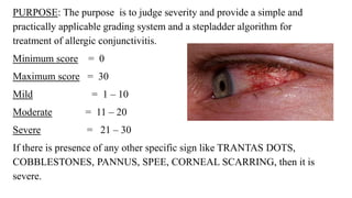 TREATING ALLERGIC EYES | PPTX