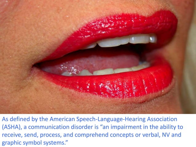 Speech and Language Impairments (SLI) | PPTX
