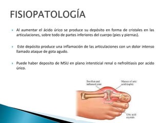 HIPERURICEMIA Y GOTA FISIOPATOLOGÍA | PPTX