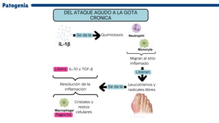 Gota y pseudogota expo de reumatologia medicina | PDF