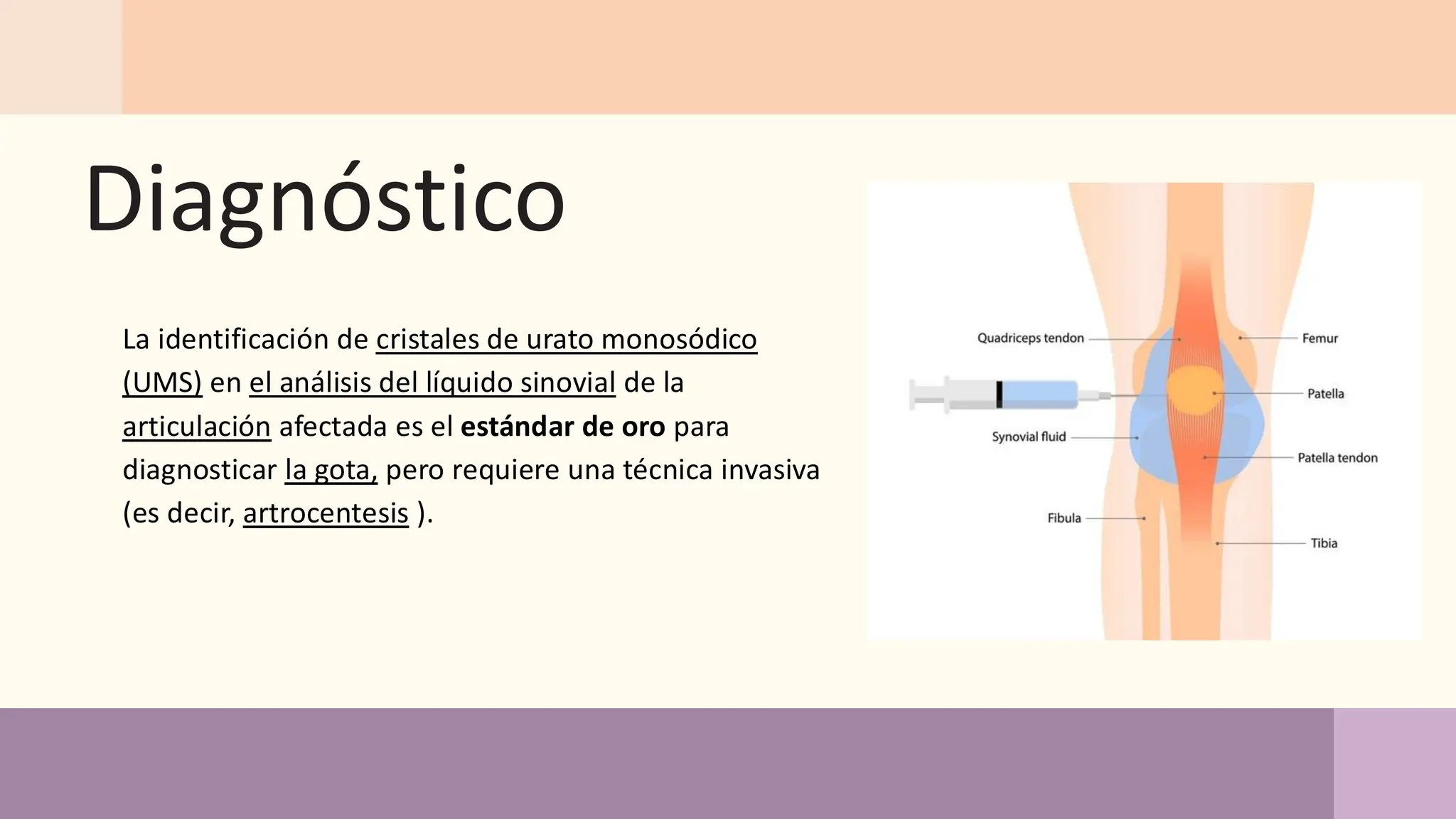 La gota es una enfermedad producida por una acumulación de cristales de ...