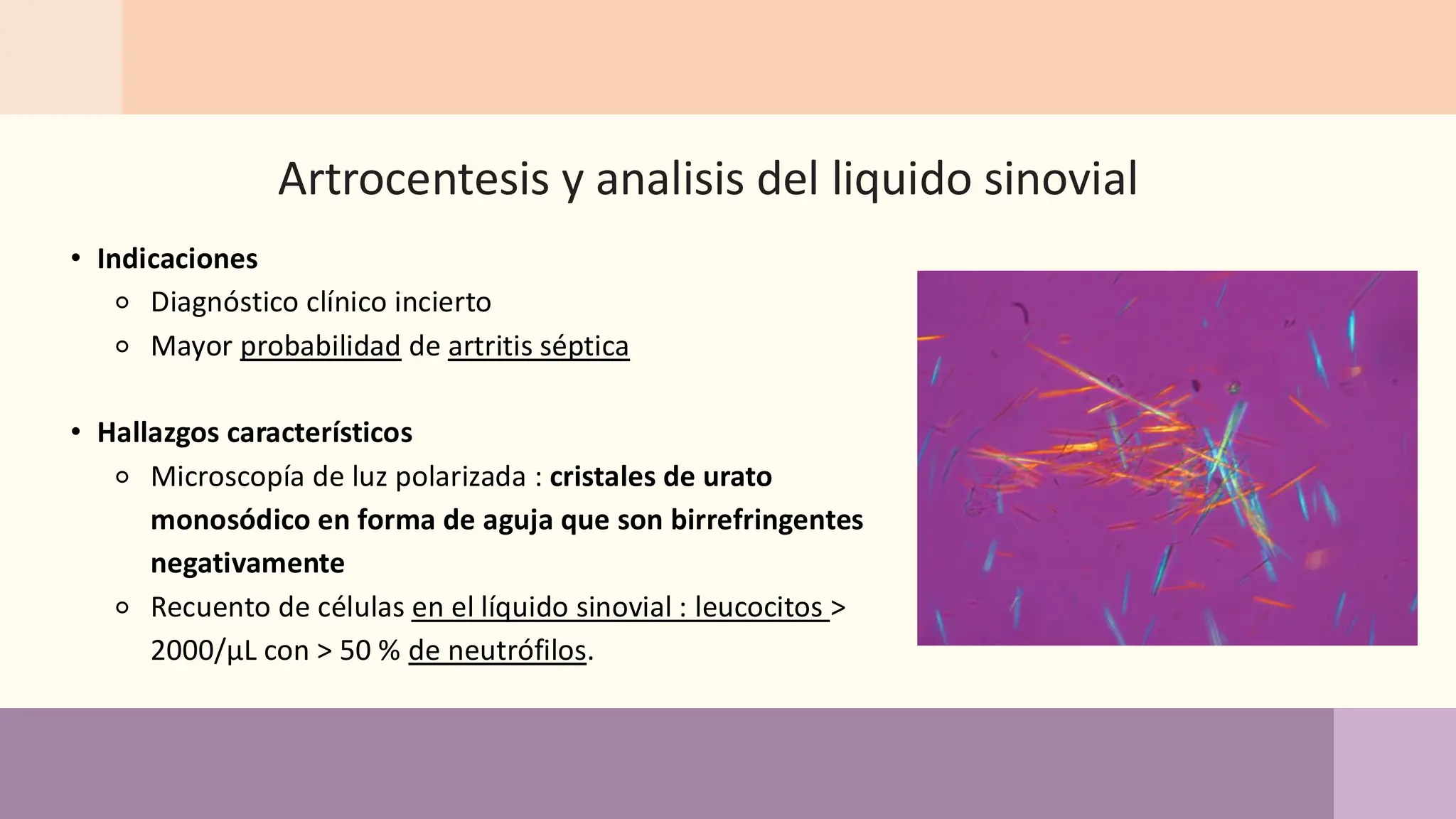 La gota es una enfermedad producida por una acumulación de cristales de ...