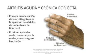 GOTA Y PSEUDOGOTA.pptx