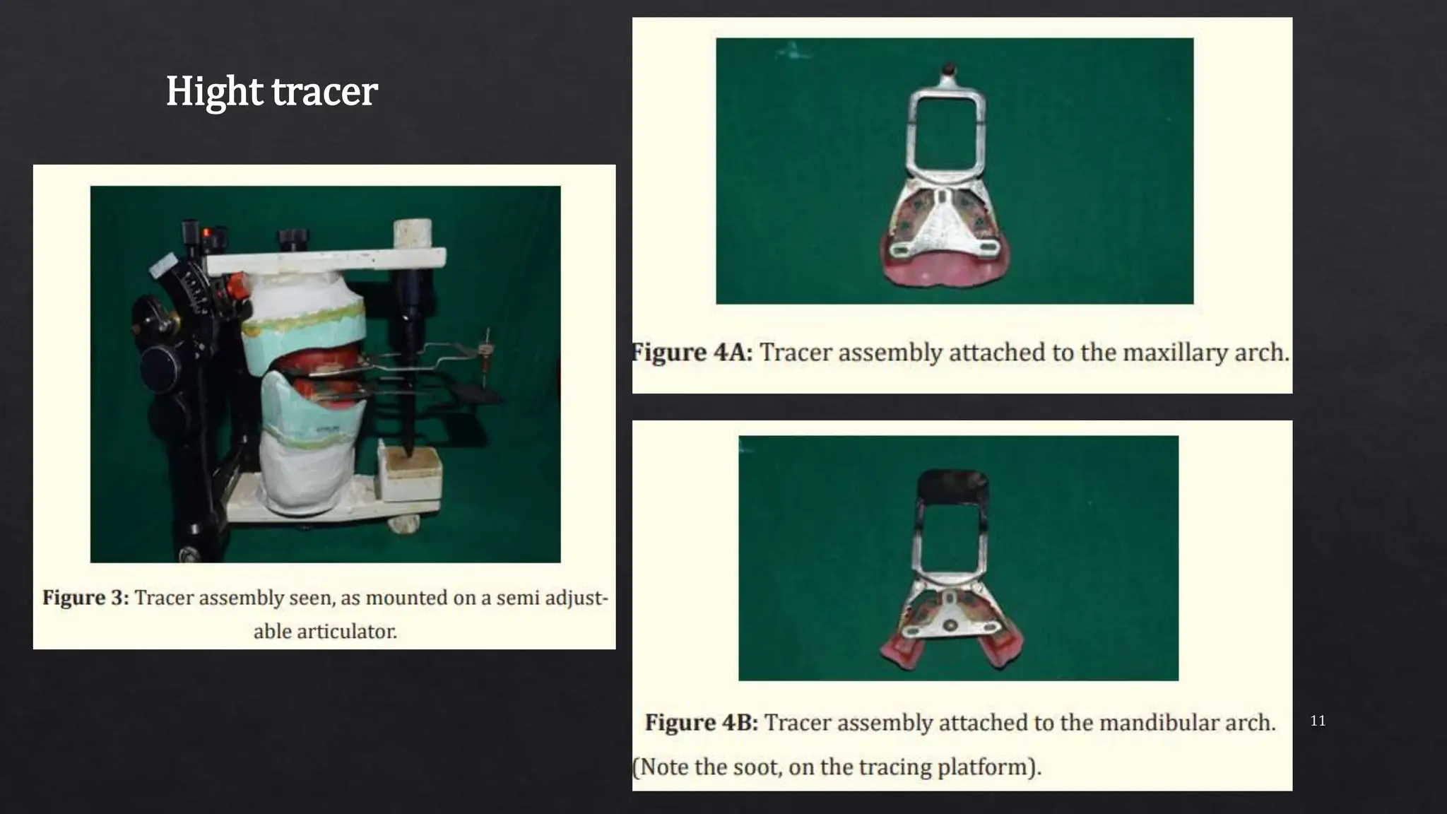 gothic arch tracing.pptx