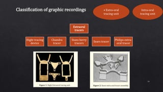 gothic arch tracing.pptx