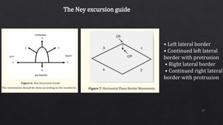 gothic arch tracing.pptx
