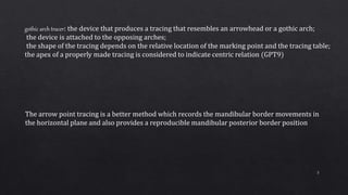 gothic arch tracing.pptx