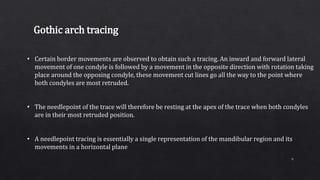 gothic arch tracing.pptx