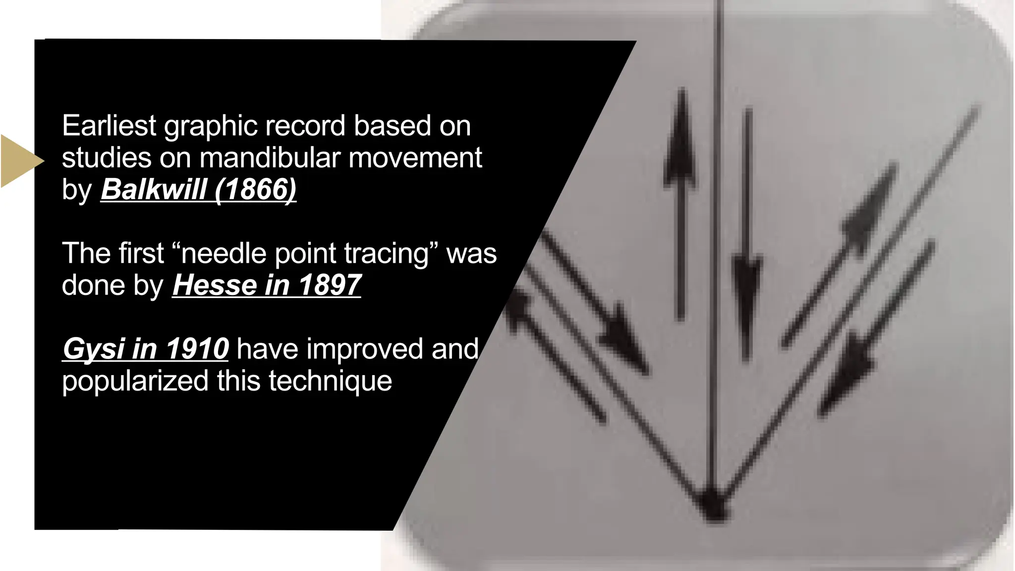 Gothic Arch Tracing classification and procedure | PPTX