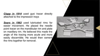 Gothic Arch Tracing classification and procedure | PPTX