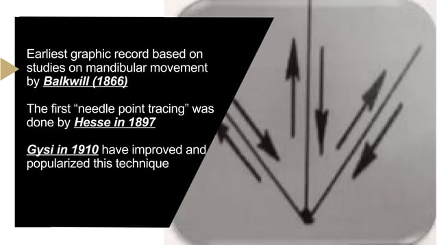 Gothic Arch Tracing classification and procedure | PPTX