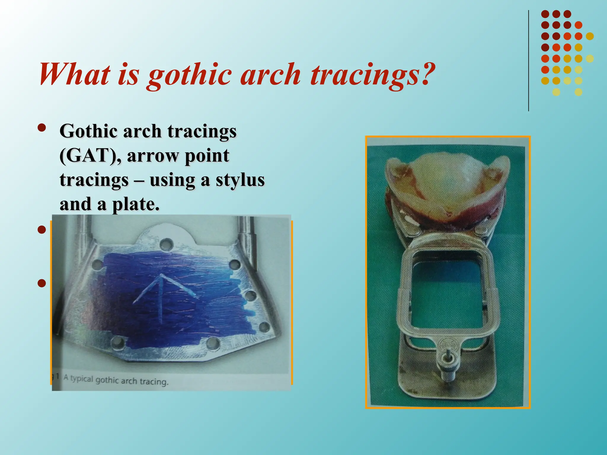 Gothic arch tracing.ppt by Dr kavan doshi | PPT
