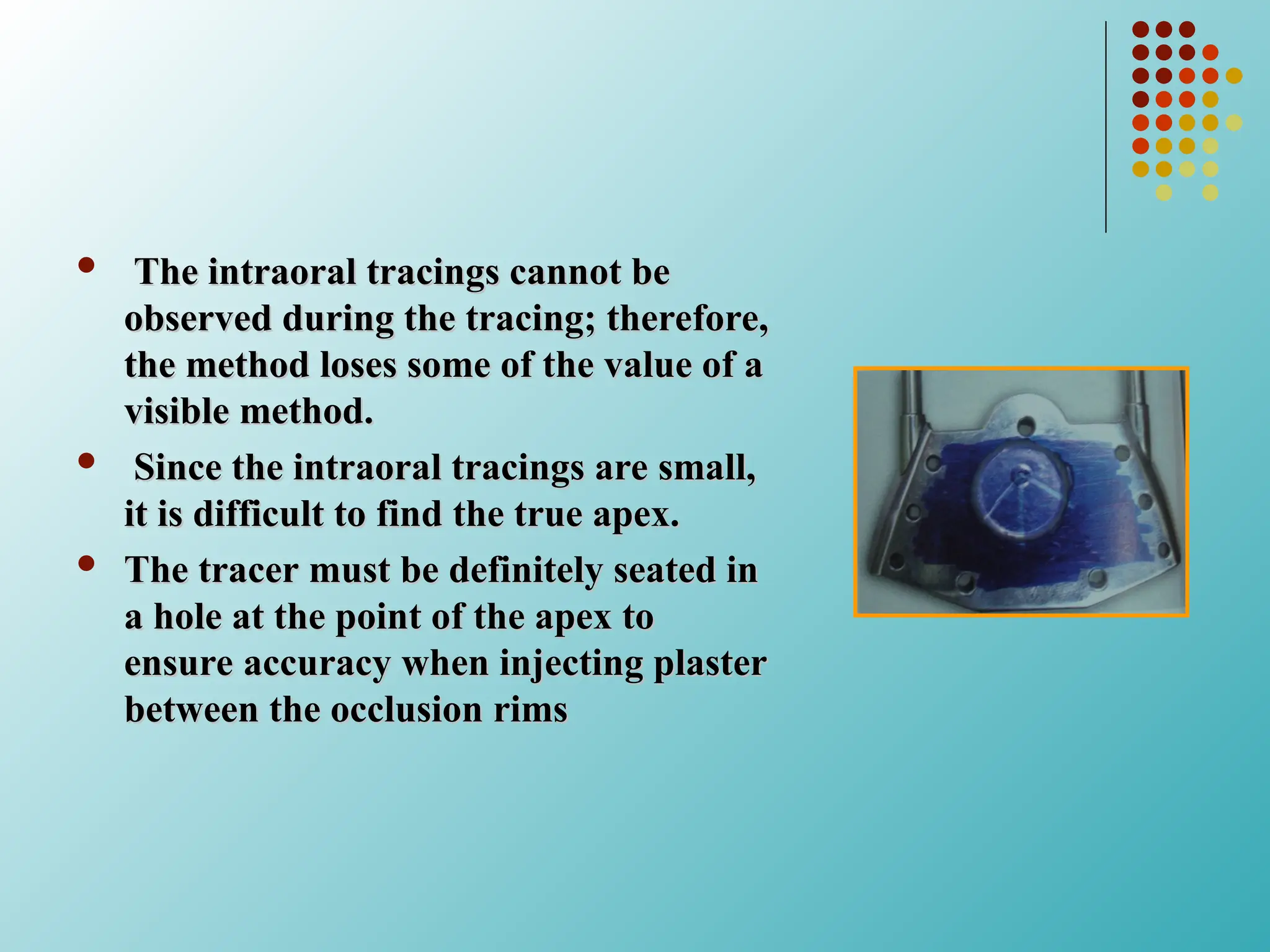 Gothic arch tracing.ppt by Dr kavan doshi | PPT