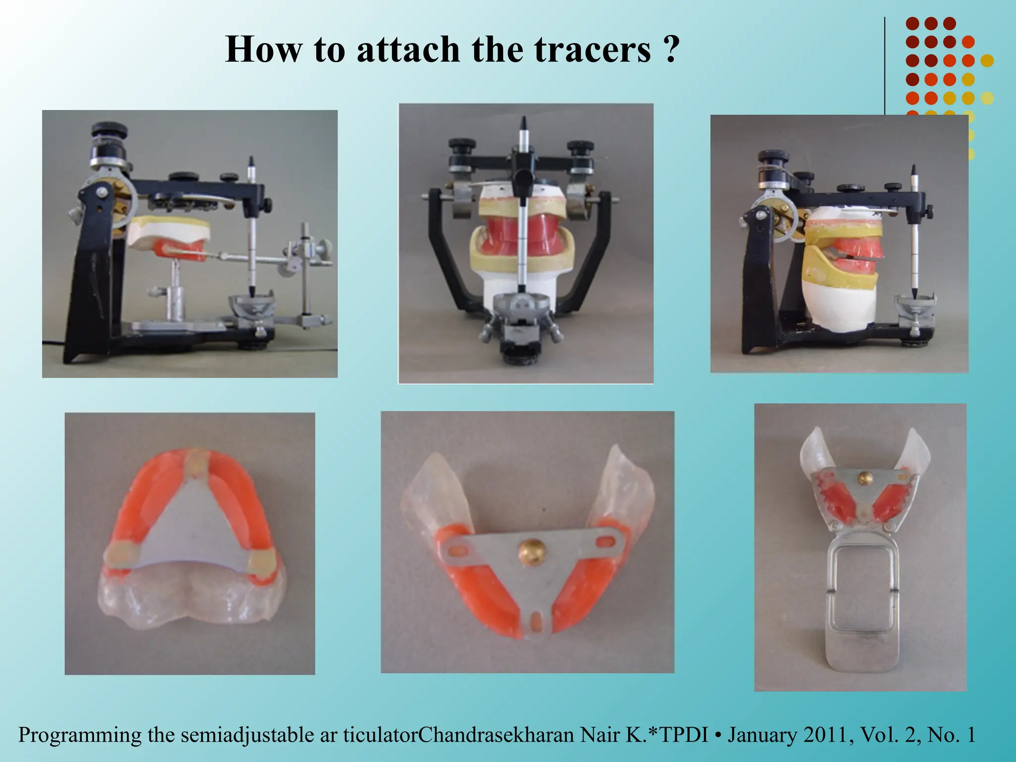 Gothic arch tracing.ppt by Dr kavan doshi | PPT