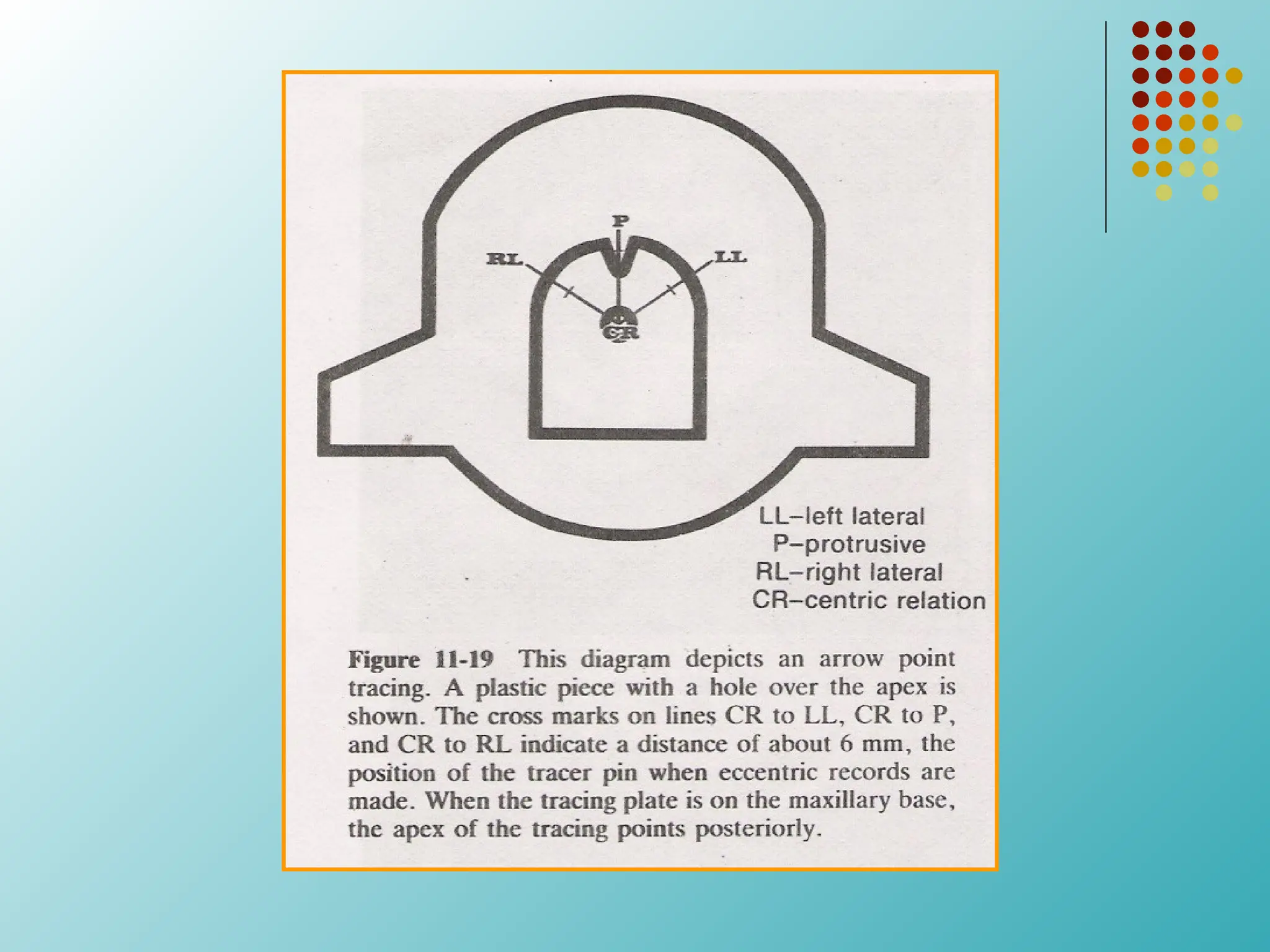 Gothic arch tracing.ppt by Dr kavan doshi | PPT