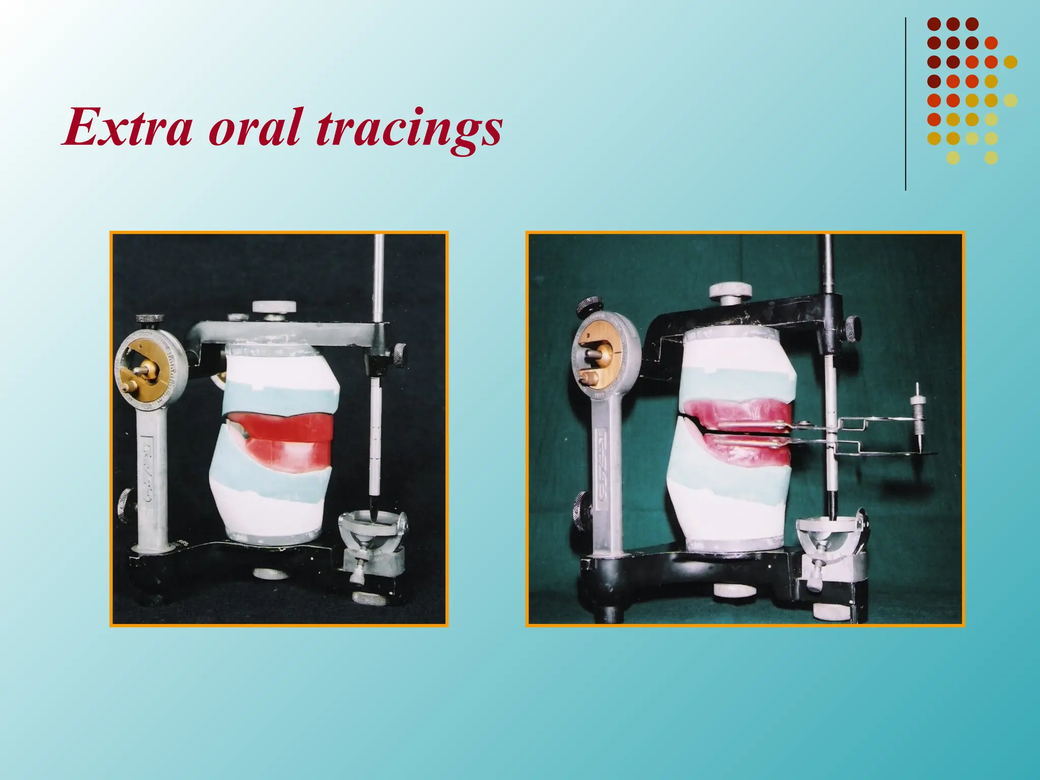 Gothic arch tracing.ppt by Dr kavan doshi | PPT