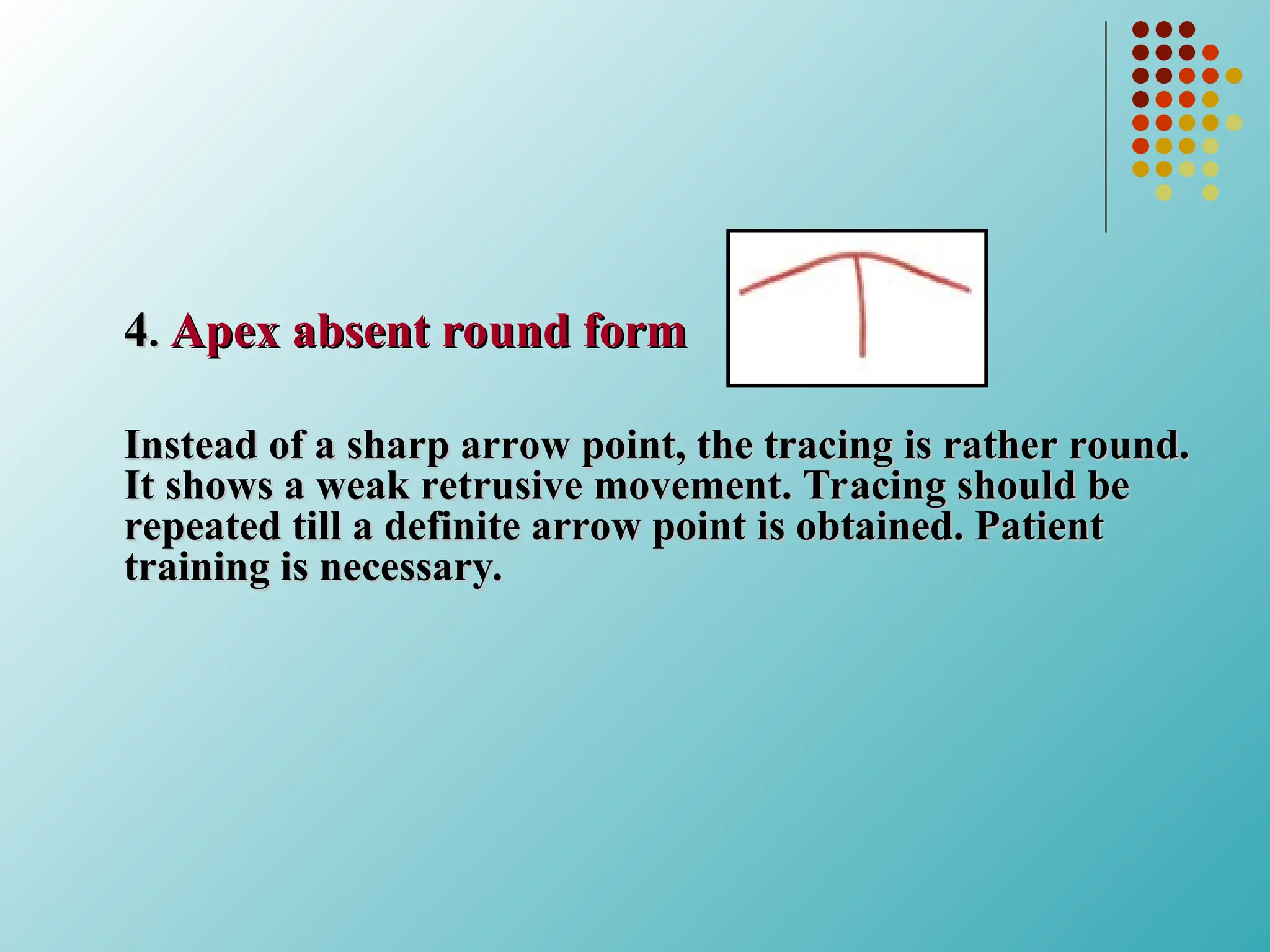 Gothic arch tracing.ppt by Dr kavan doshi | PPT