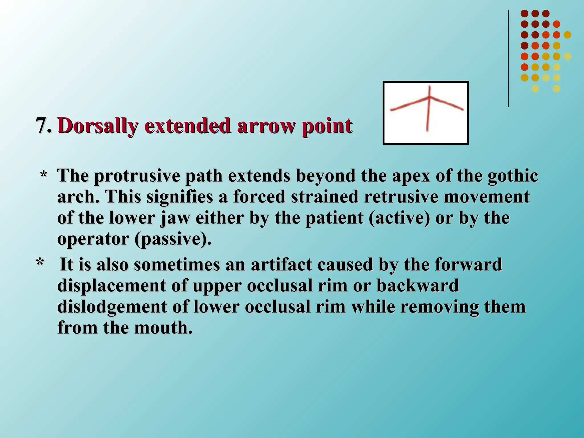 Gothic arch tracing.ppt by Dr kavan doshi | PPT