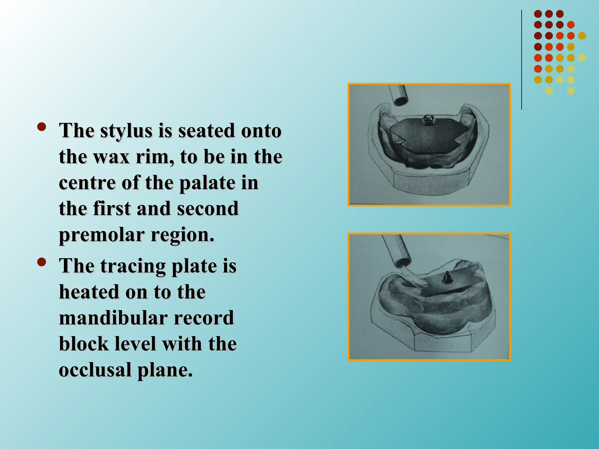 Gothic arch tracing.ppt by Dr kavan doshi | PPT