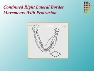 Gothic arch tracing.ppt by Dr kavan doshi | PPT