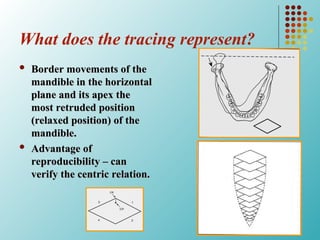 Gothic arch tracing.ppt by Dr kavan doshi | PPT