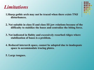 Gothic arch tracing.ppt by Dr kavan doshi | PPT